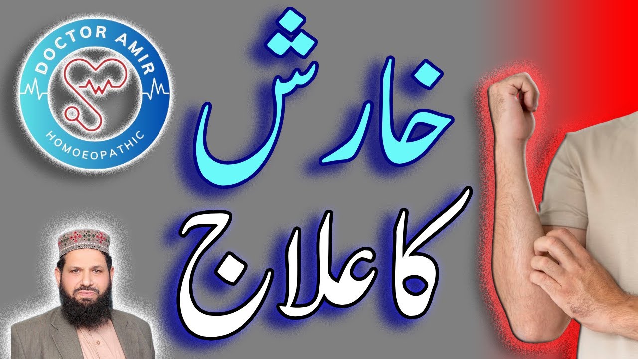 Kharish Ka Ilaj | Itch Cure with Homeopathic Medicine - YouTube