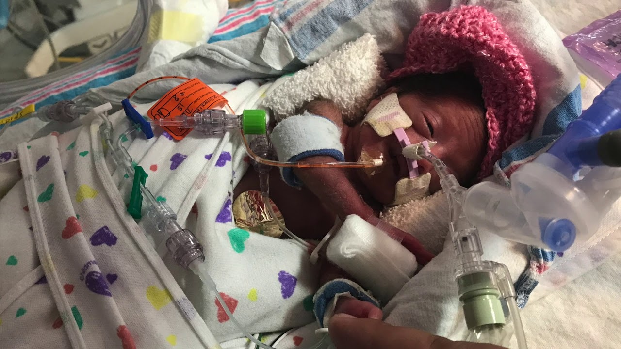 Baby born at 23 weeks..SURVIVES ! - YouTube