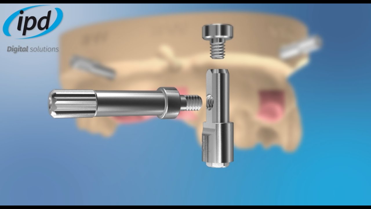 IPD - Digital Analog (English) - YouTube