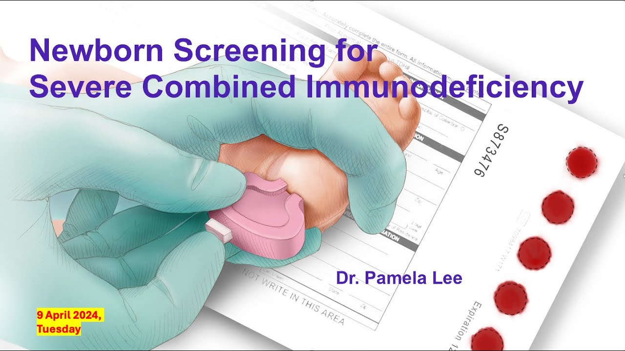 Newborn Screening for Severe Combined Immunodeficiency (SCID) by Dr ...