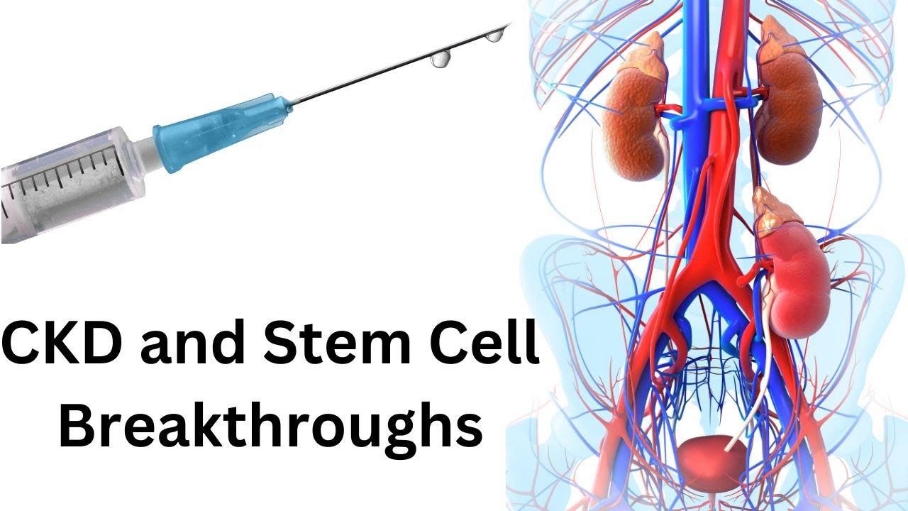 CKD and Stem Cell Breakthroughs: Changing the Landscape of Kidney Care ...