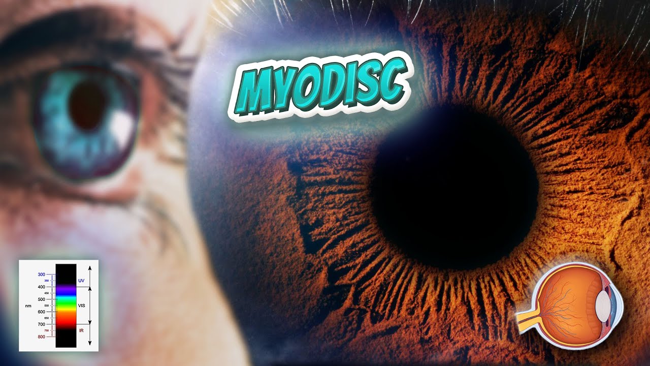Myodisc - Your EYEBALLS - EYNTK 👁️👁️💉😳💊🔊💯 - YouTube