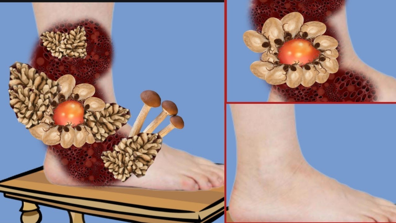 ASMR/Satisfying ticks removal animation# ...