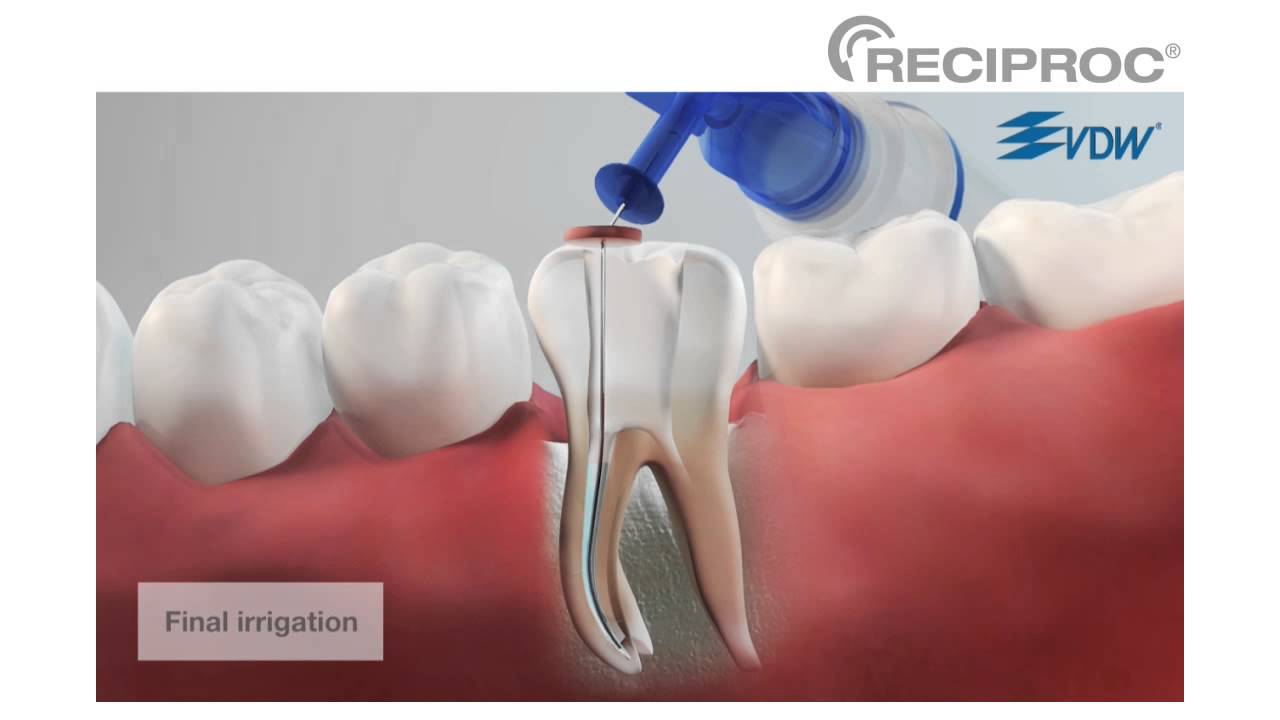 VDW - System RECIPROC - YouTube