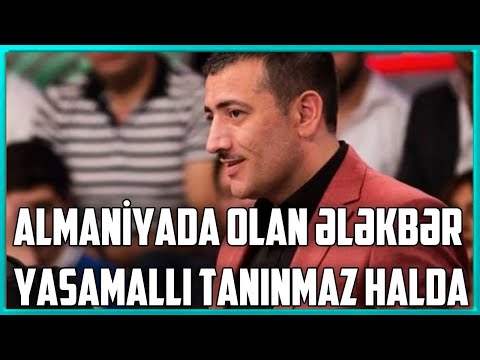 Almaniyada olan Ələkbər Yasamallı tanınmaz halda