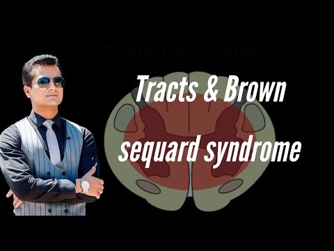 Pyramidal tract, spinothalamic tract , dorsal column, brown seqward syndrome. #neuroanatomy #tracts
