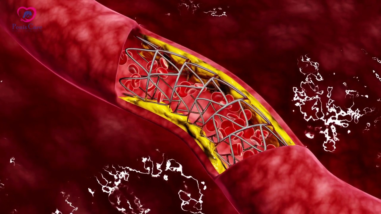 Top 3 Natural Ways to Blood Flow Instantly - YouTube