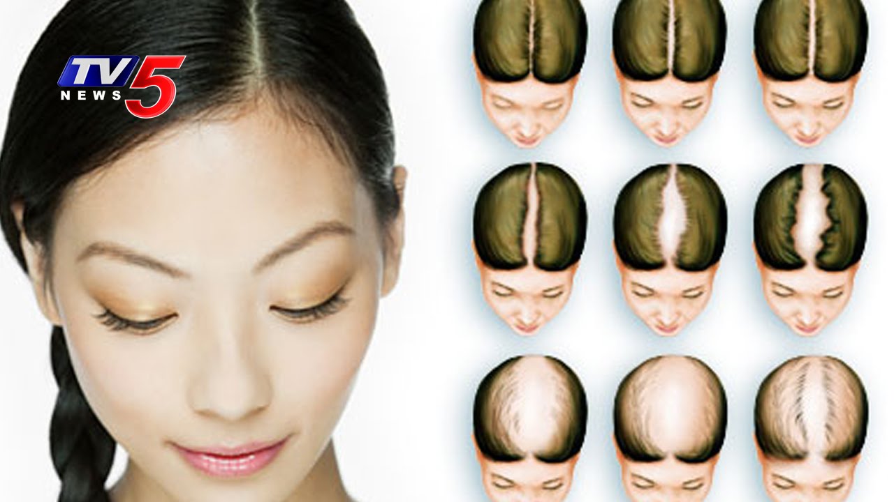 Causes & Latest Treatments For Hair Fall Problems | Vibes Clinic ...