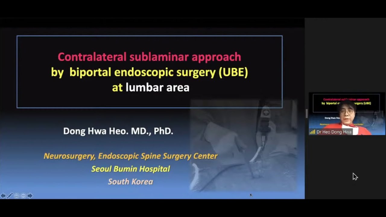 Contralateral Sublaminar Approach by Biportal Endoscopic Surgery (UBE ...