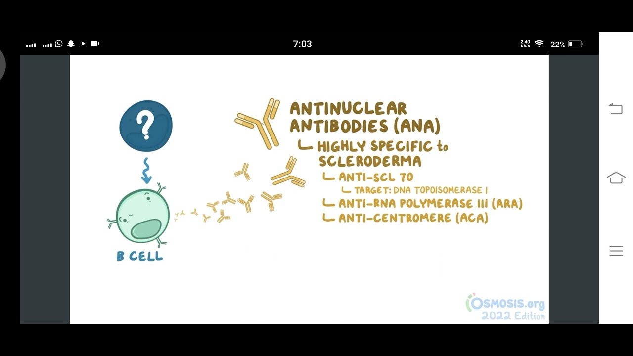 Systemic Sclerosis | Scleroderma | osmosis - YouTube