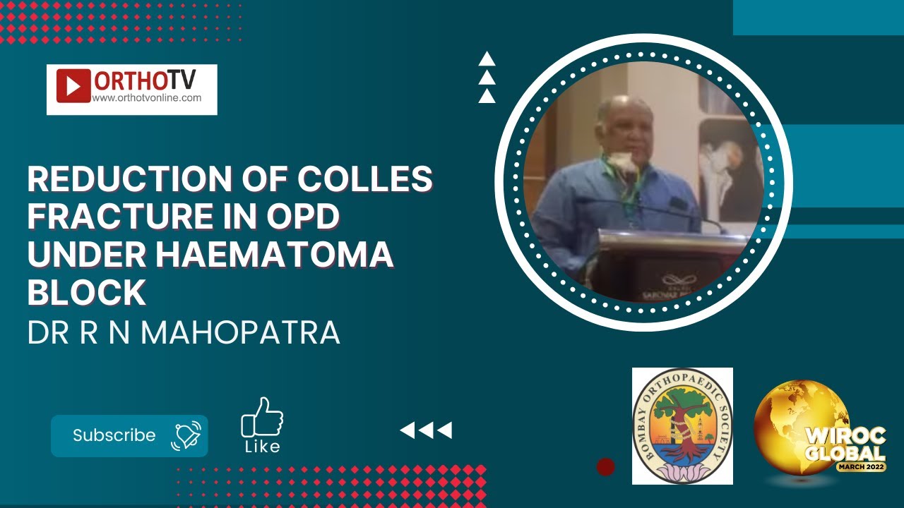 Reduction of Colles Fracture in OPD under Haematoma Block - Dr R N ...