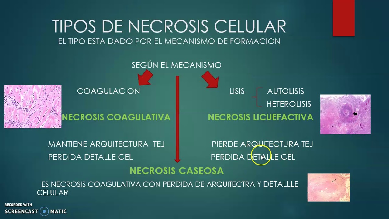 MUERTE CELULAR - YouTube