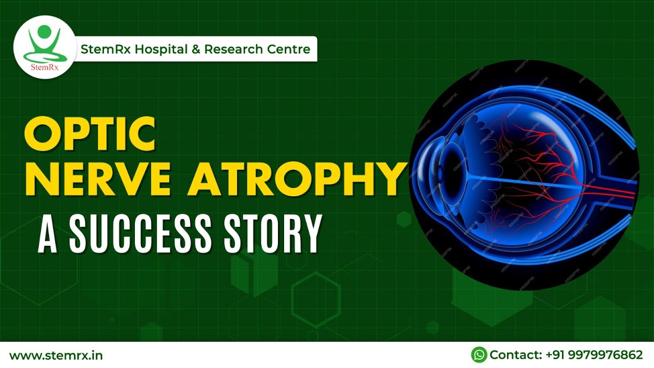 Overcoming Optic Nerve Atrophy: A Remarkable Recovery Journey at StemRx ...