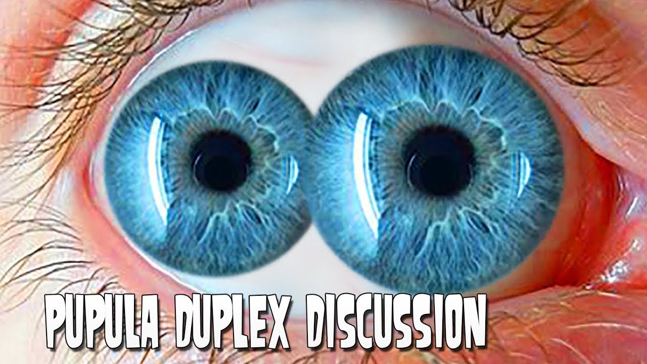 Pupula Duplex = Double Eyes - YouTube