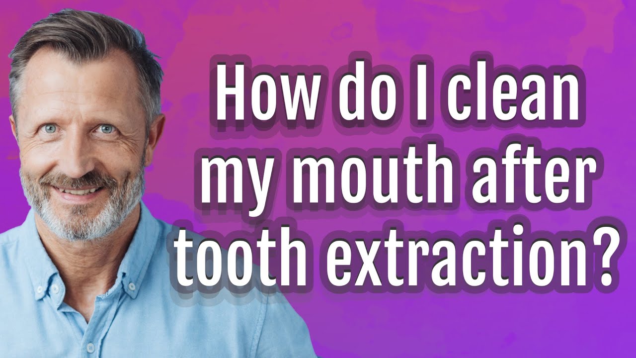 How do I clean my mouth after tooth extraction? - YouTube