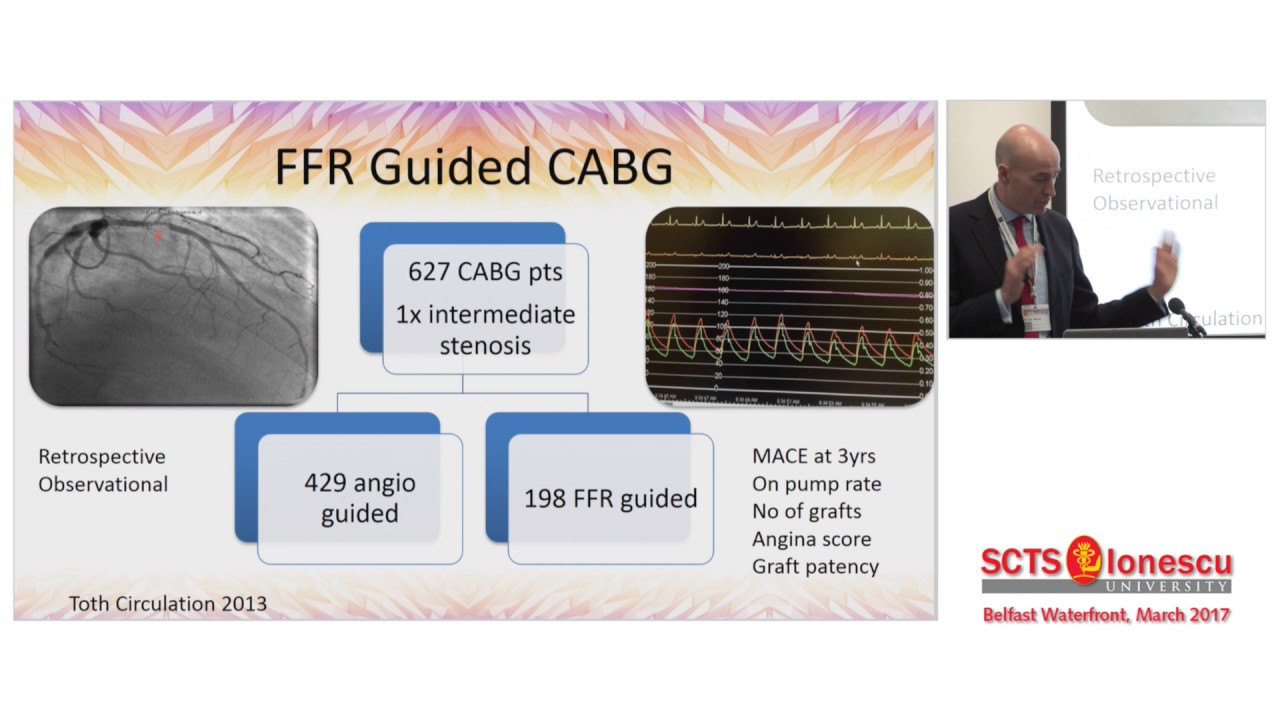 FFR and cardiac surgery - YouTube