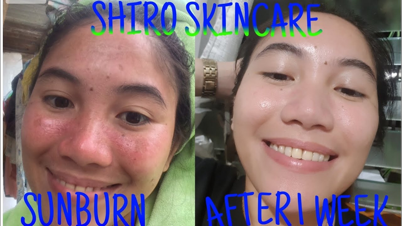 SHIRO REJUVENATING SET REVIEW Shiro for All Types of Skin | Philippines ...
