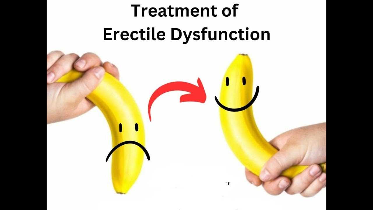 Erectile dysfunction Or impotence ; Definition, Causes, Symptoms ...