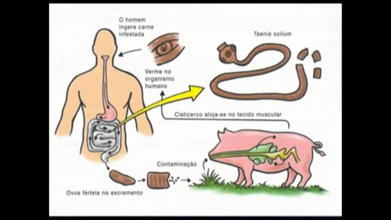 Slide Teníase - YouTube