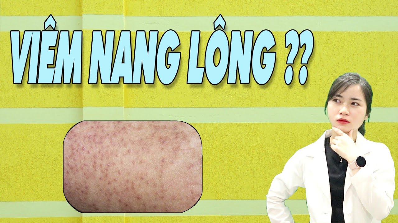VIÊM NANG LÔNG hay DÀY SỪNG NANG LÔNG? Cách trị dày sừng nang lông hiệu ...