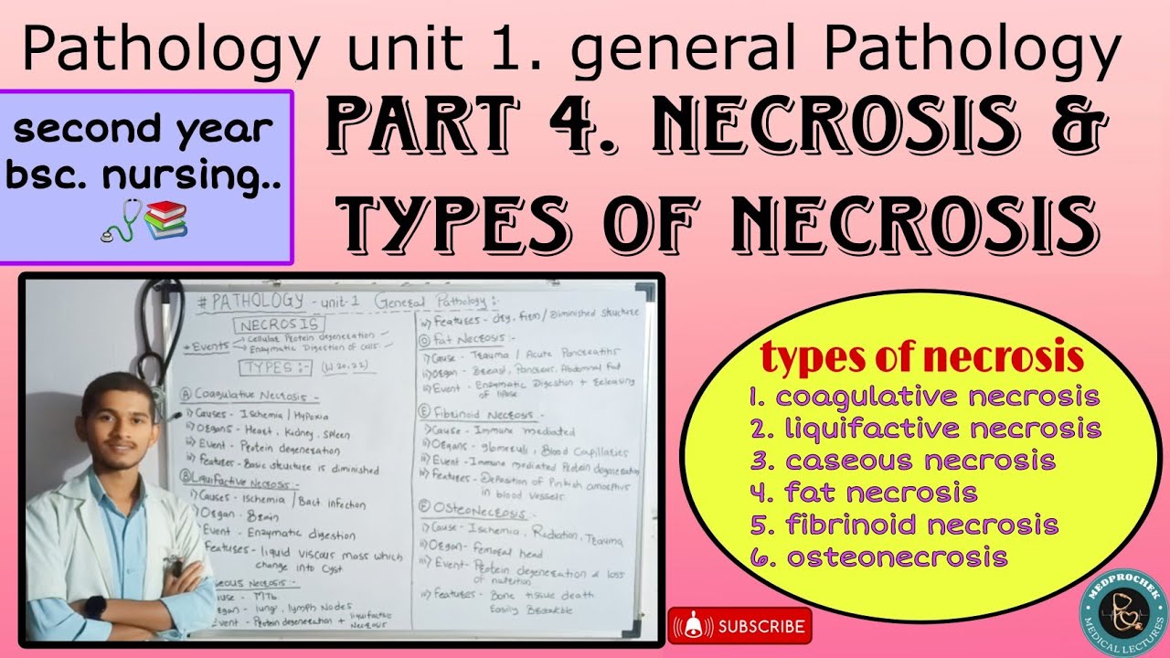 Necrosis. types of necrosisn. || Bsc nursing second year pathology ...