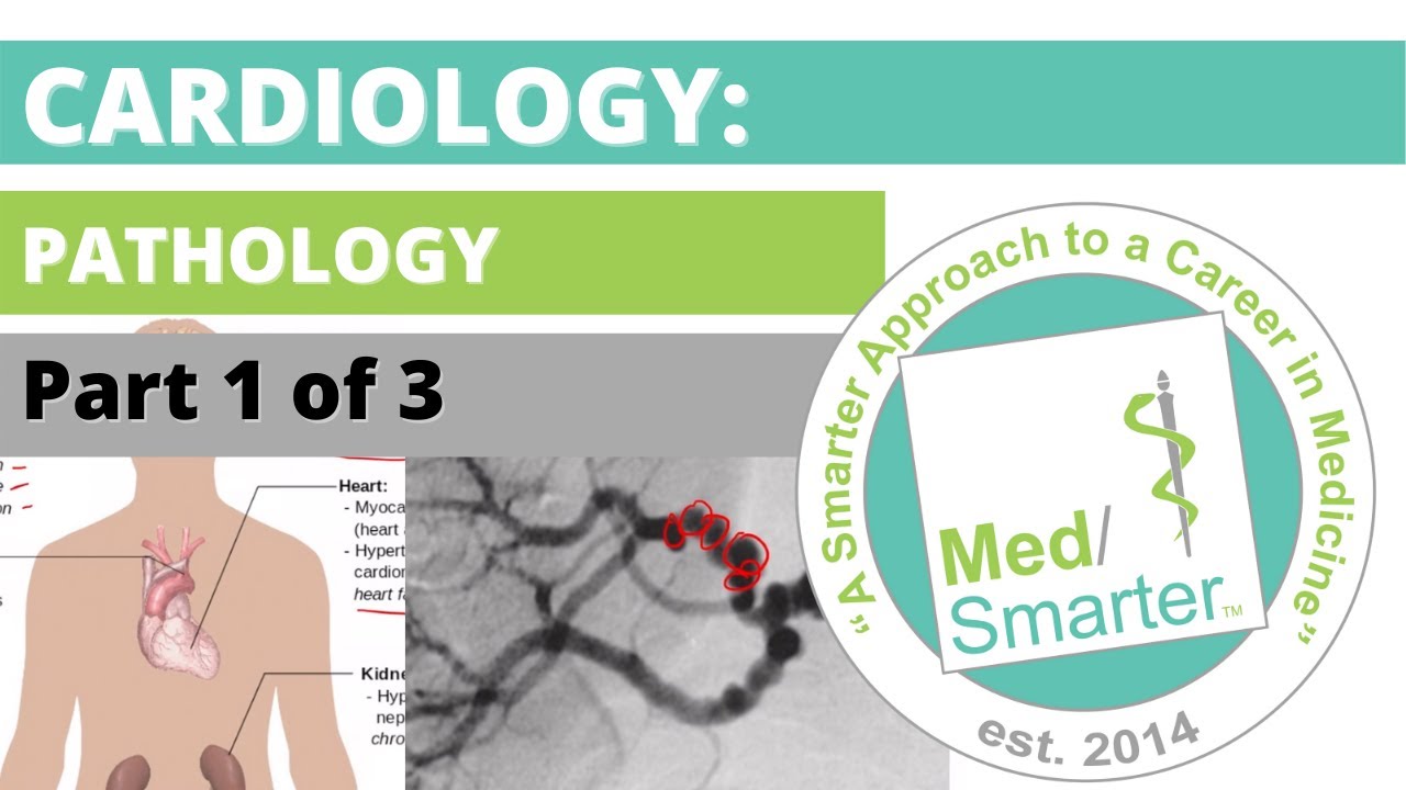 USMLE Step 1 | Cardiology: Pathology | MedSmarter | Part 1 of 3 - YouTube