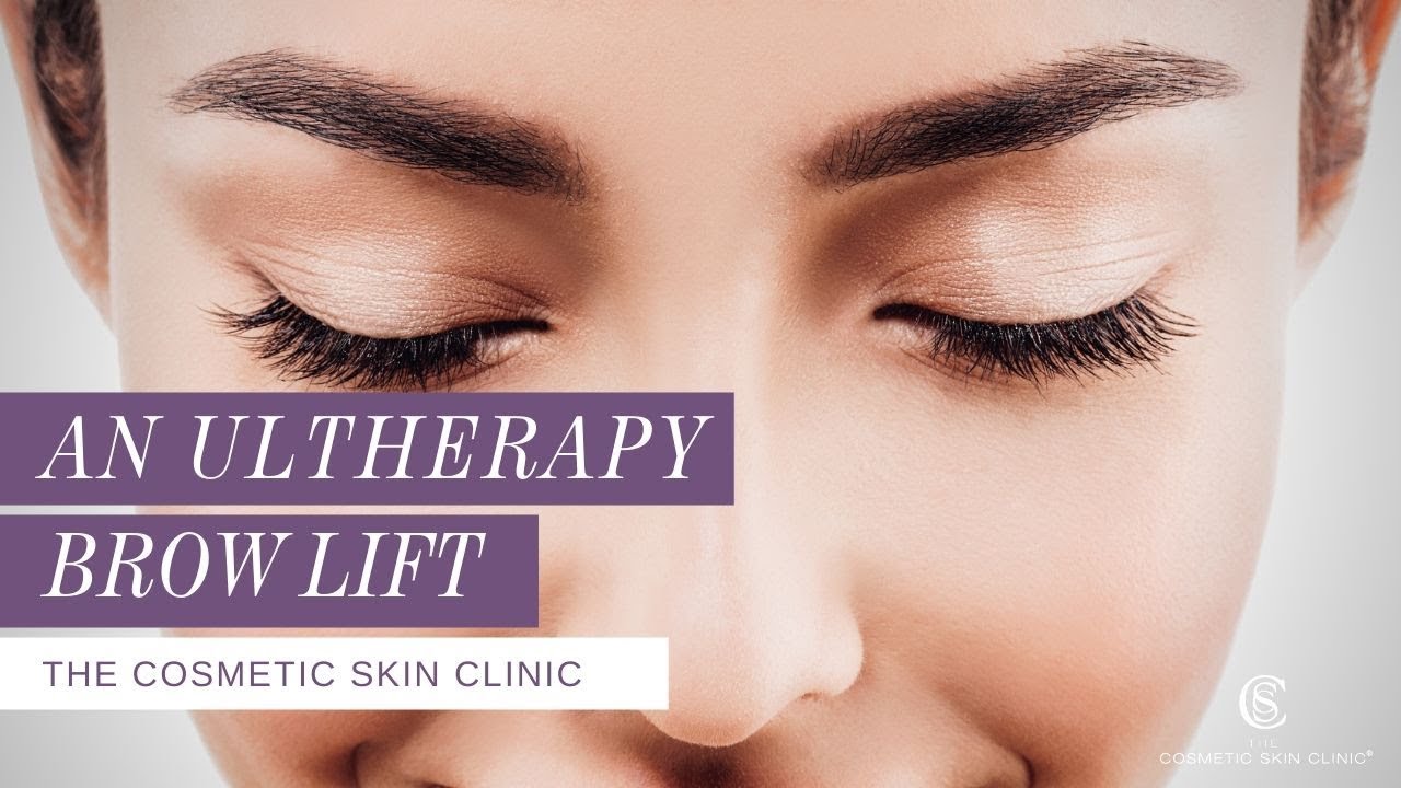 Ultherapy Brow Lift Treatment | The Cosmetic Skin Clinic - YouTube