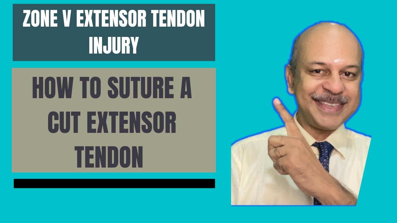 Zone V Extensor injury:How to repair a cut extensor tendon, and follow ...
