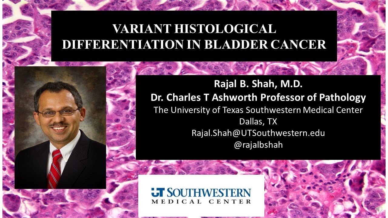 A Dummies Guide to Variant Histological Differentiation in Bladder ...