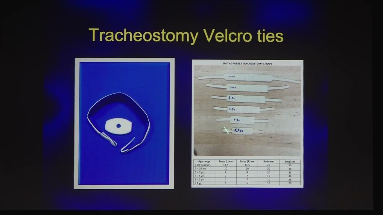8 Tracheostomy Care And Decannulation Protocol Youtube