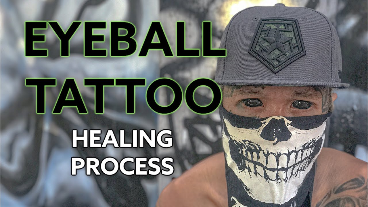 EYEBALL TATTOO HEALING PROCESS I SOLAR BOY - YouTube