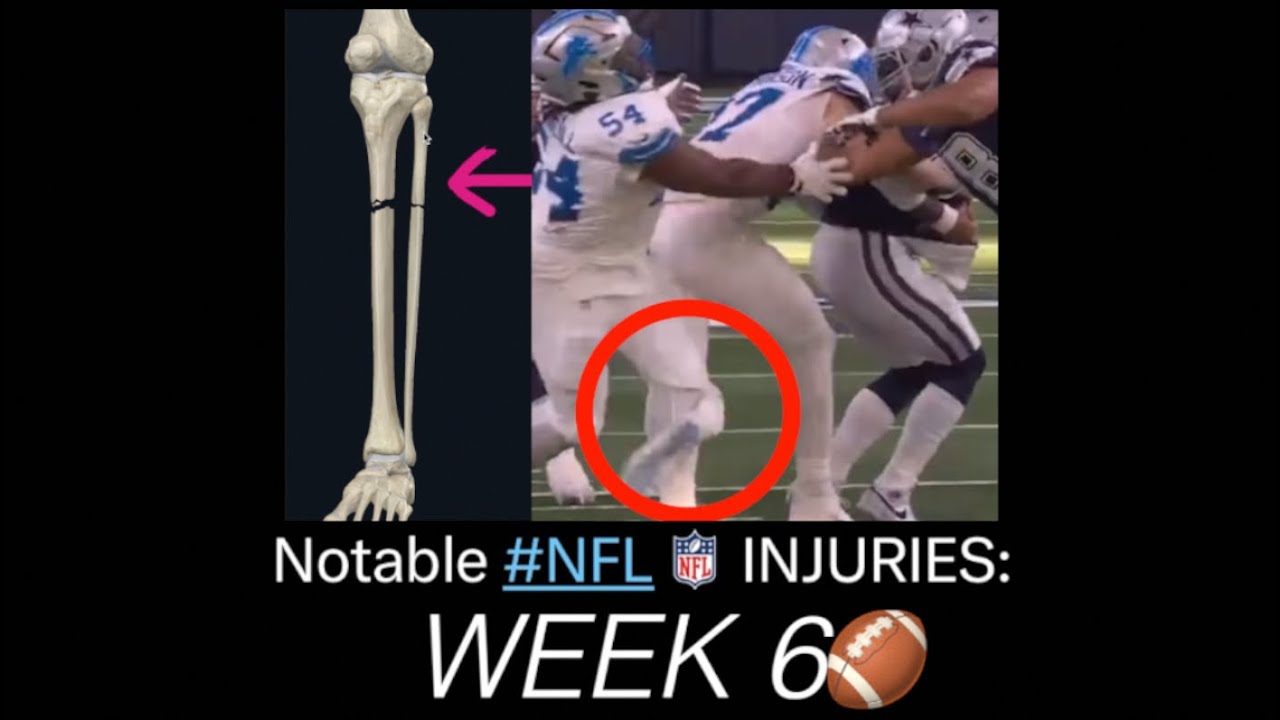 Data analysis: Week 6 #NFL Injuries | FASTEST medical minute # ...