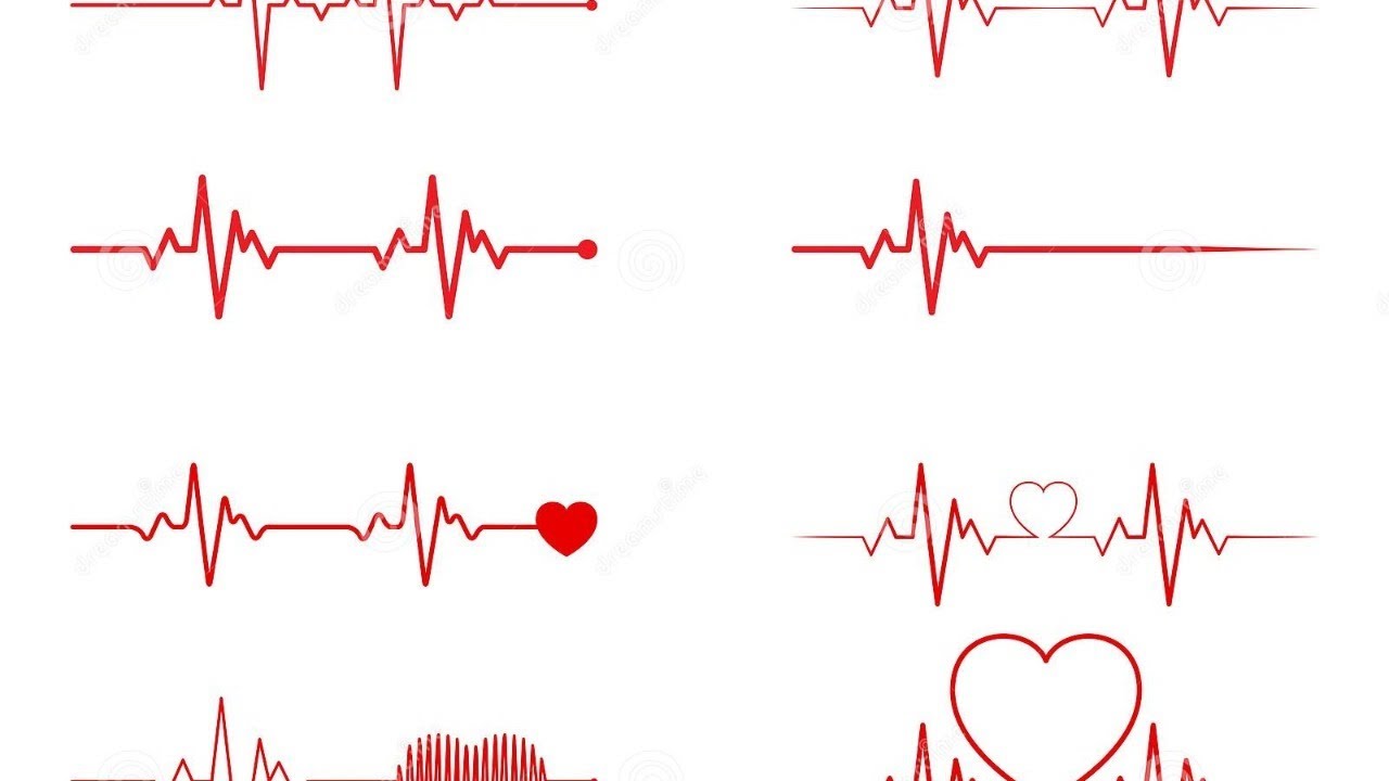 Escuela Dominical, Como Esta Tu Corazón ? - YouTube