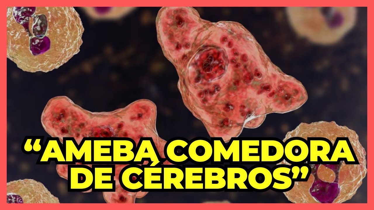 Naegleria fowleri a "Ameba Comedora de Cérebro" - YouTube