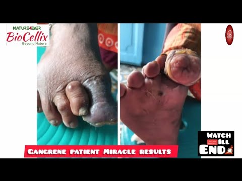 Part 5 Nature4ever.com BioCellx SteamCell Therapy Product Miracle ...
