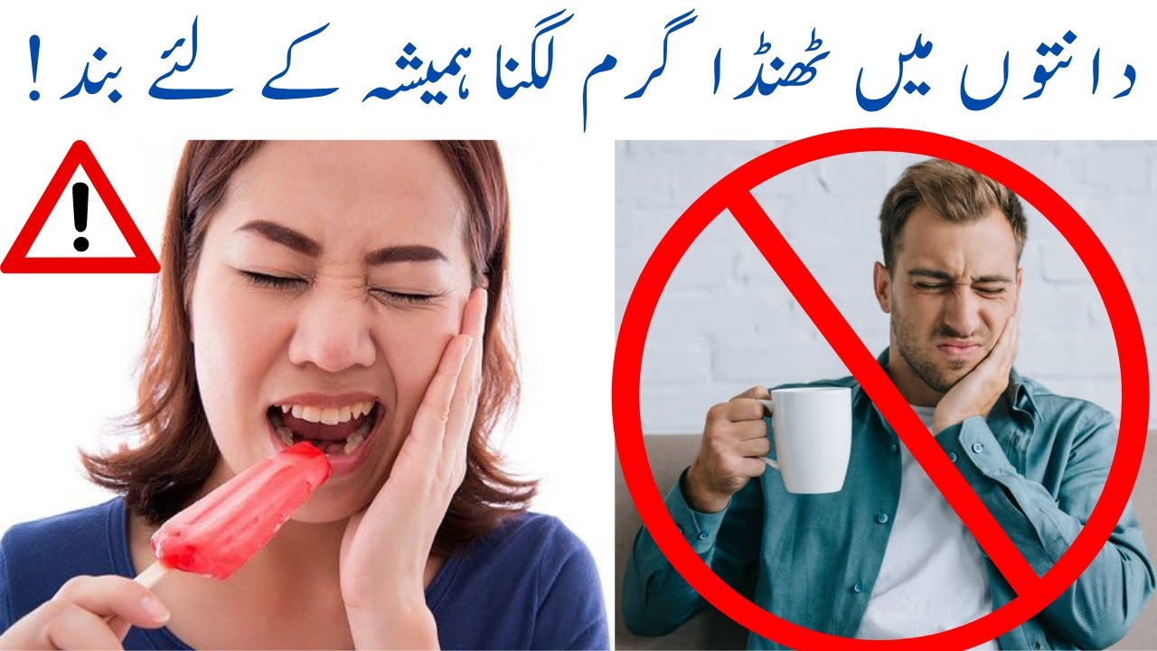 Danto Ko Thanda Garam Lagne Ka Ilaj - DR.BILL - YouTube