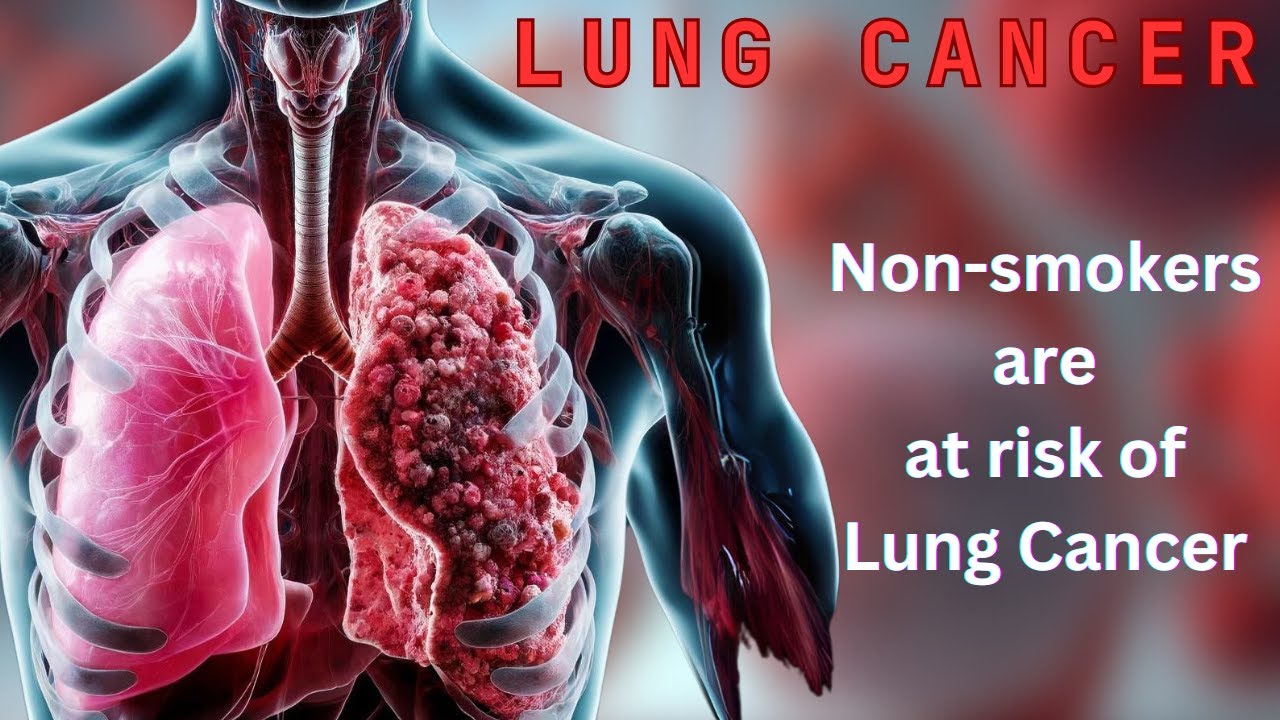 Complete Guide to Lung Cancer: Causes, Symptoms, and Cutting-Edge ...