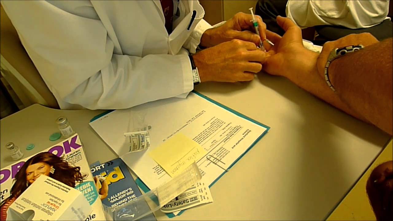 Dupuytren's Contracture Xiaflex Injection right hand - YouTube