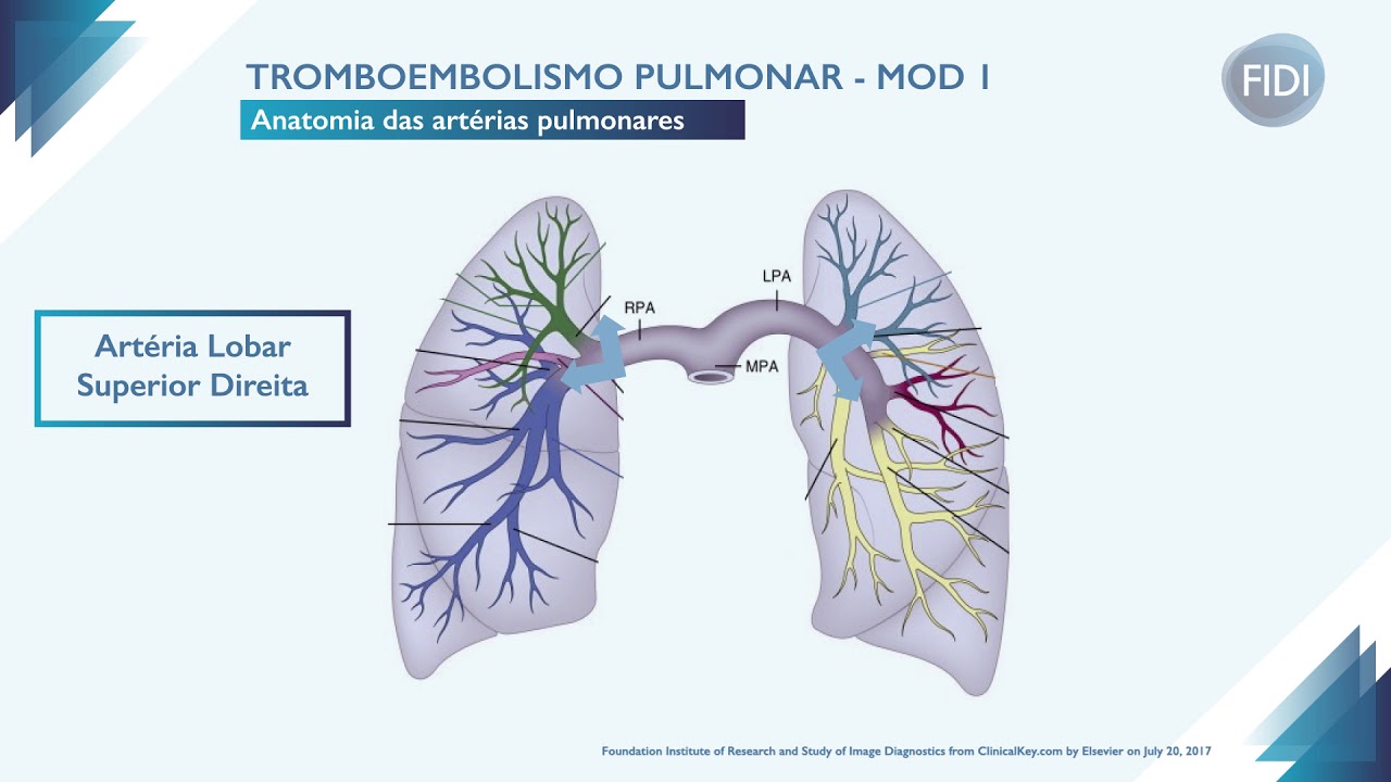 Anatomia Da Arteria Pulmonar Direita Artéria Coronária única Com