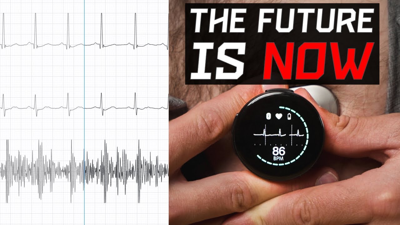 EKO Core & Core 500 Review (World's Most Advanced Stethoscopes) - YouTube