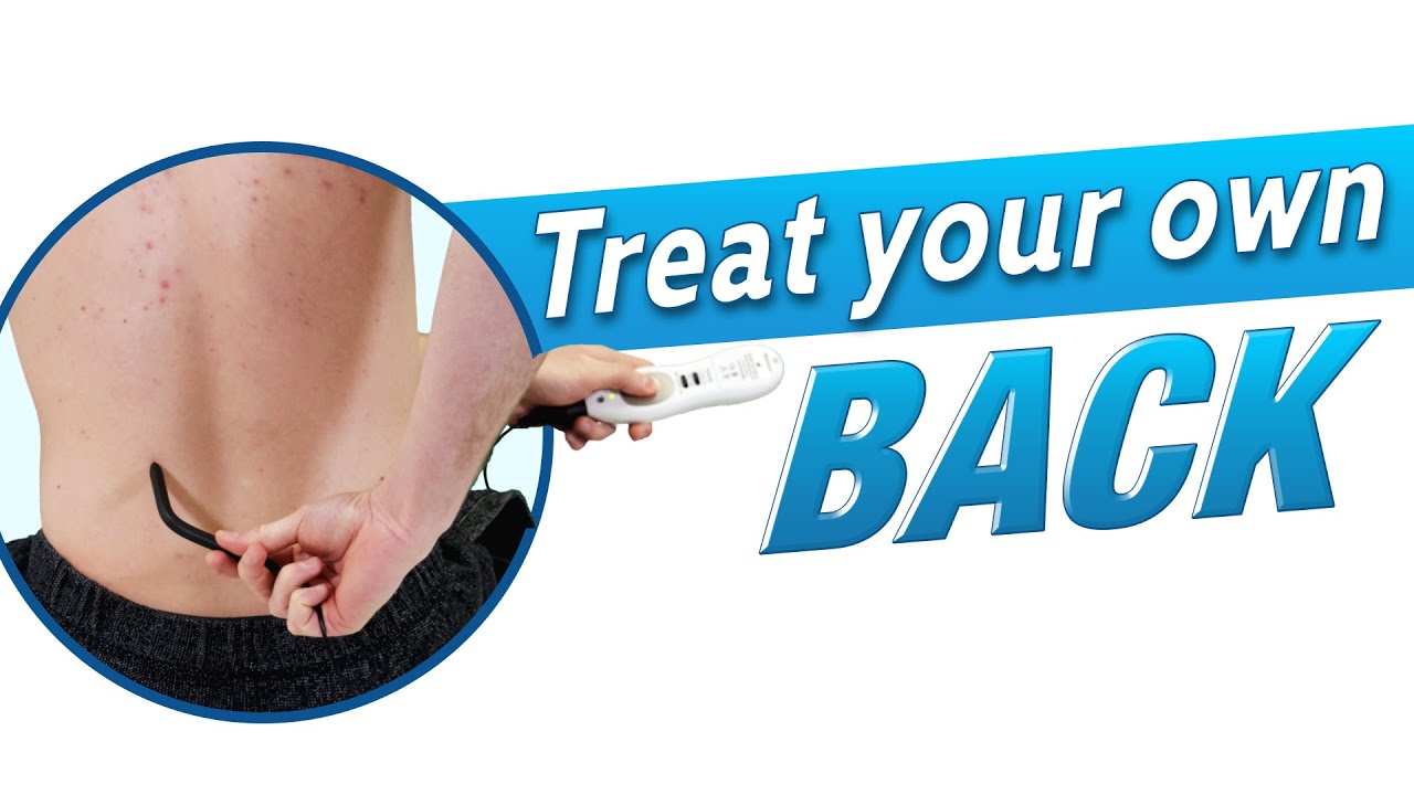 How to treat your own back with Dolphin Neurostim device? - YouTube
