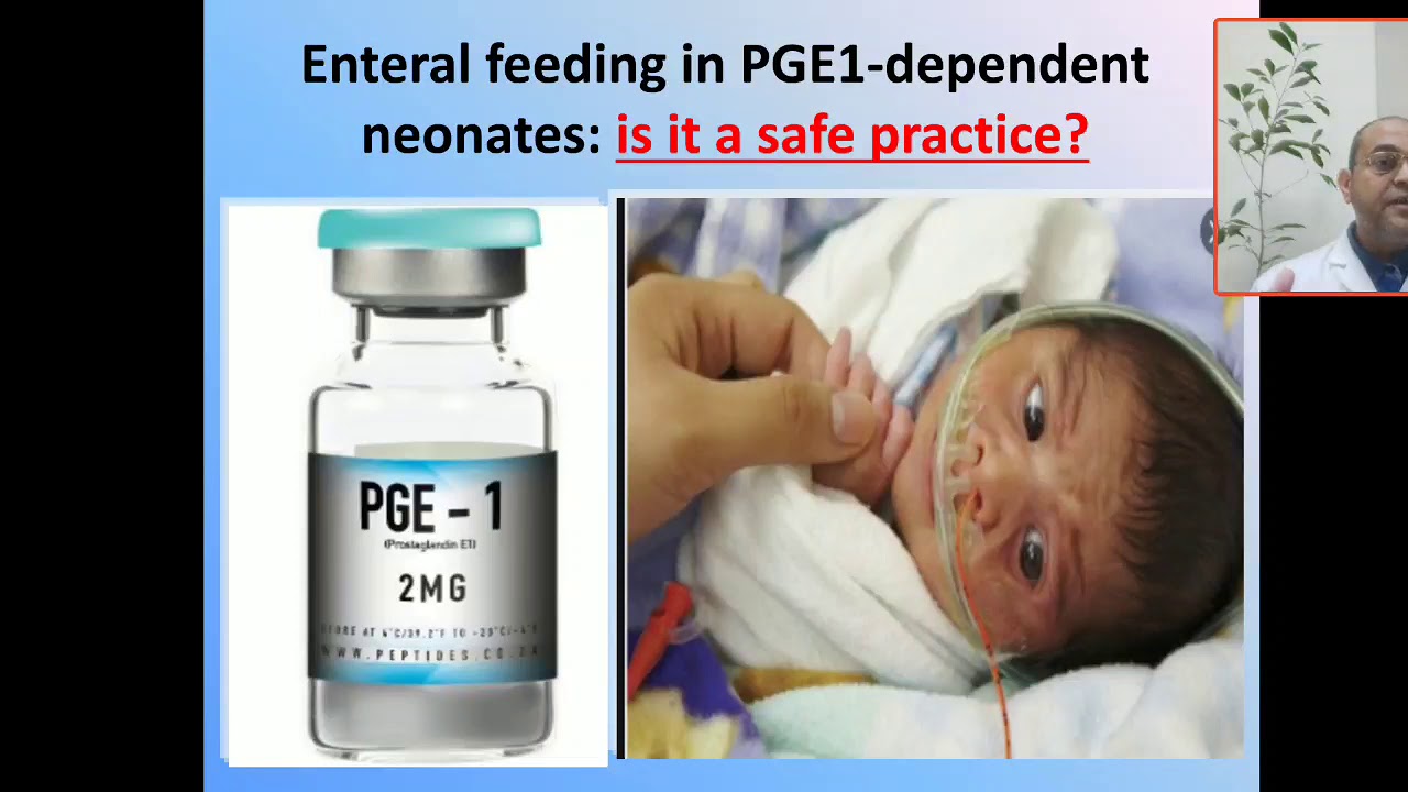 Enteral feeding in PGE1 dependent neonates, is it safe practice? CCHD ...