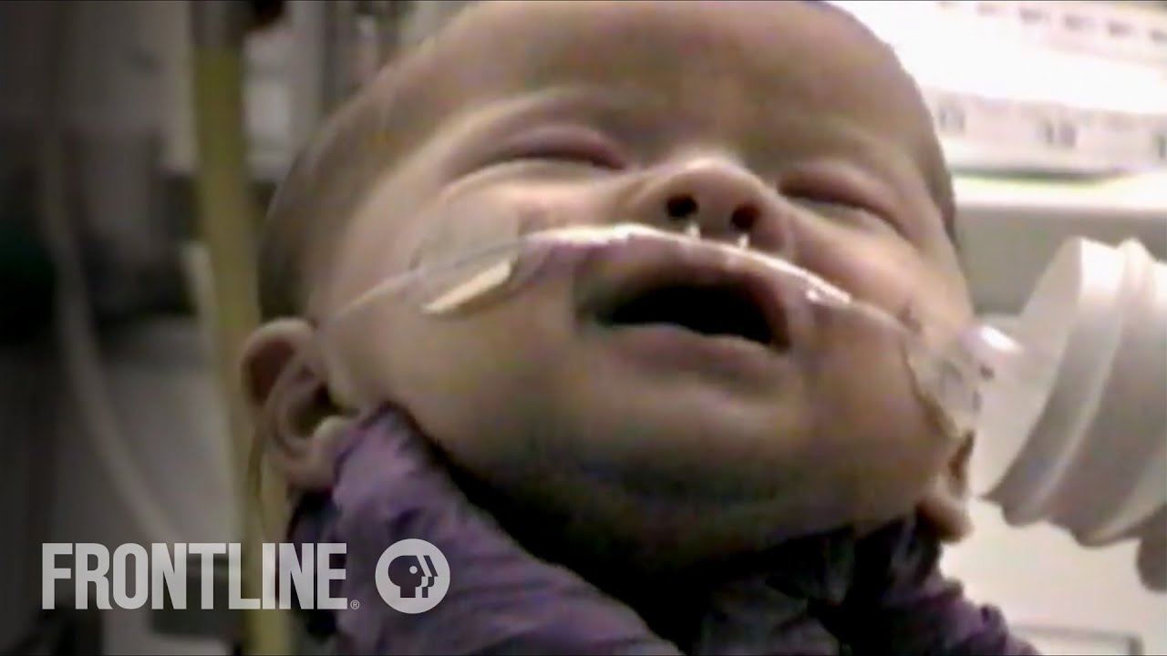This Is What Whooping Cough Looks Like | The Vaccine War | FRONTLINE ...