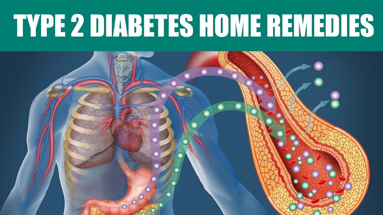 10 Natural Home Remedies for Type 2 Diabetes - YouTube