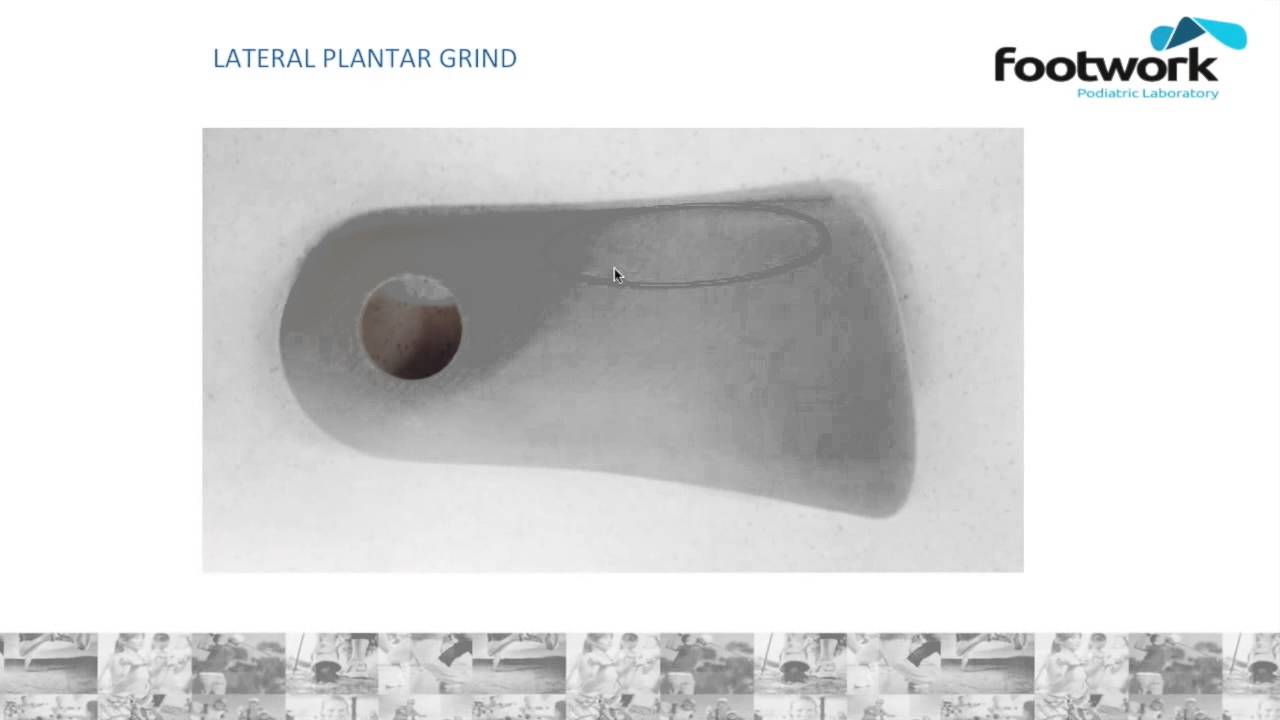 (6) Shell Modifications — Lateral Plantar Grind - YouTube