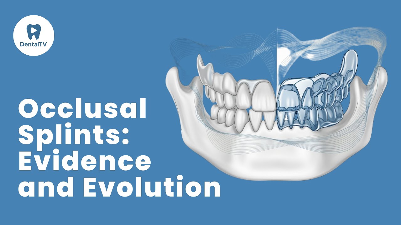 Occlusal Splints: Rethinking Their Use in Modern Dentistry | The ...