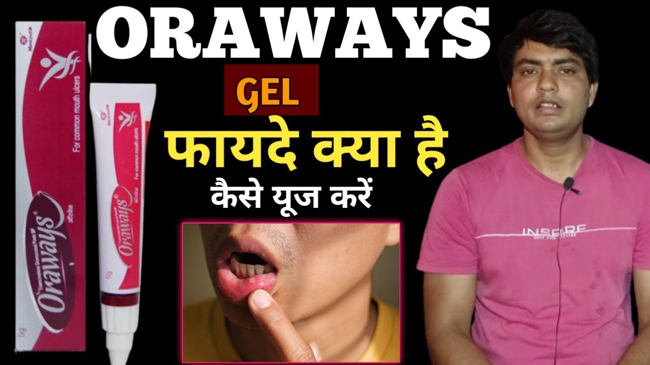 oraways gel uses in hindi | oraways kaise use kare | oraways gel ...