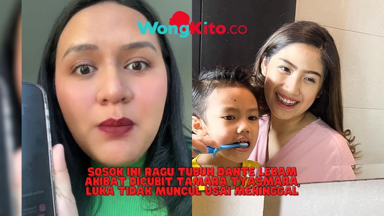 Sosok Ini Ragu Tubuh Dante Lebam Akibat Dicubit Tamara Tyasmara, Luka Tidak Muncul Usai ...
