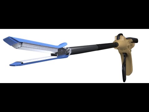 Staple line reinforcement for Sleeve Gastrectomy for bariatric surgery ...