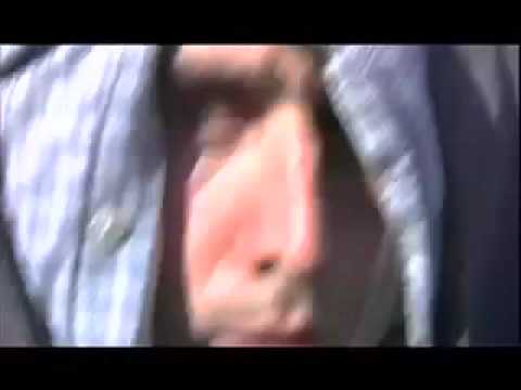 FACE ON A STOMACH?? DEFORMITY? SIMESE TWINS...FREAK u OUT! - YouTube